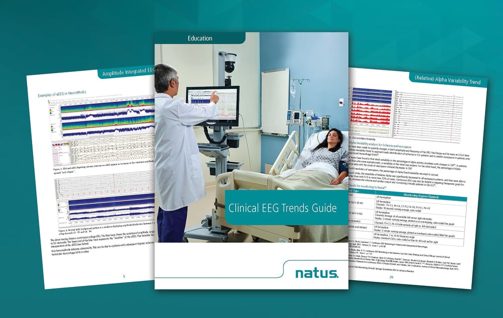 Free guide: Clinical EEG Trends